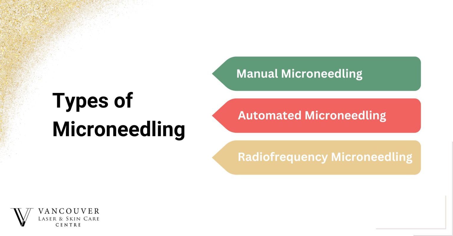 What Does Microneedling Do? - Vancouver Laser & Skin Care Centre