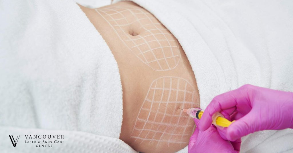 Fat Reduction Surgery Explained: Options, Risks, & Results!