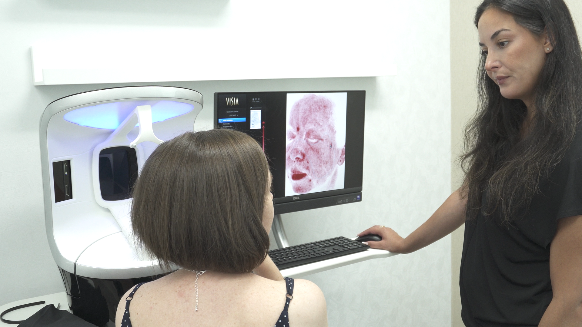 VISIA Skin Analysis: 7 Powerful Reasons to Try It